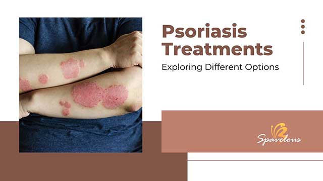 Psoriasis Treatments 101: Learn About Diagnosis And Treatment Options | Spavelous